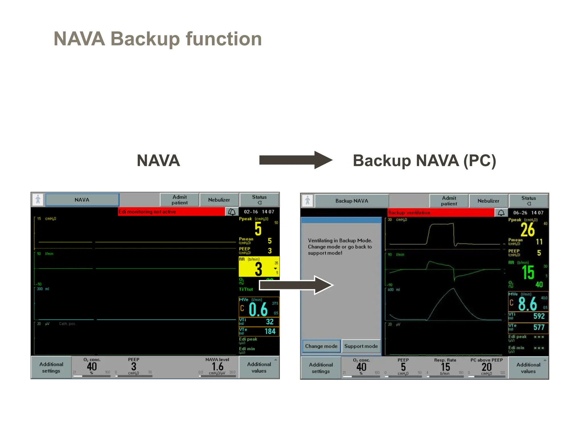 Getinge ventilation strategy using nava ventilation | PDF