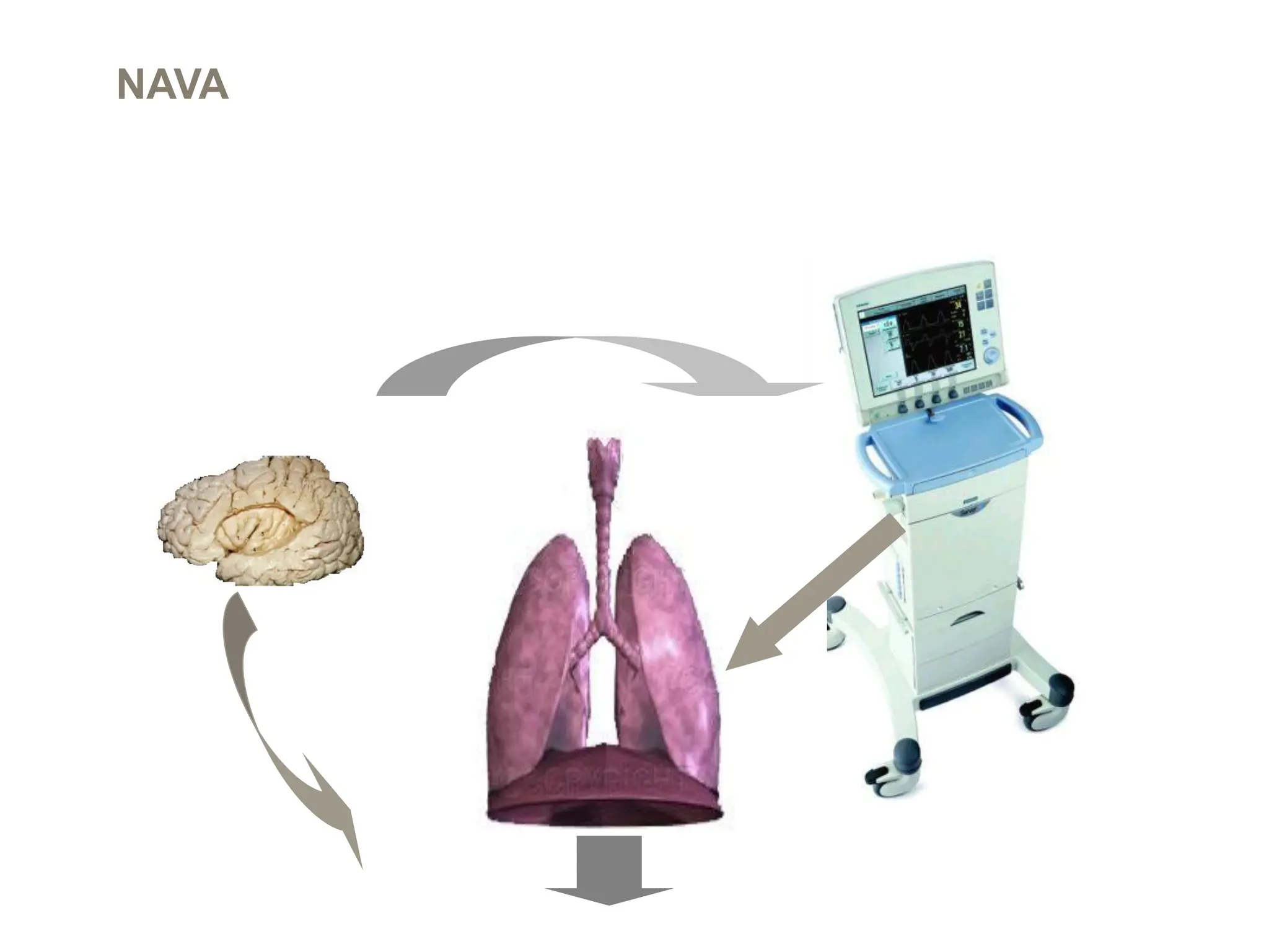 Getinge ventilation strategy using nava ventilation | PDF
