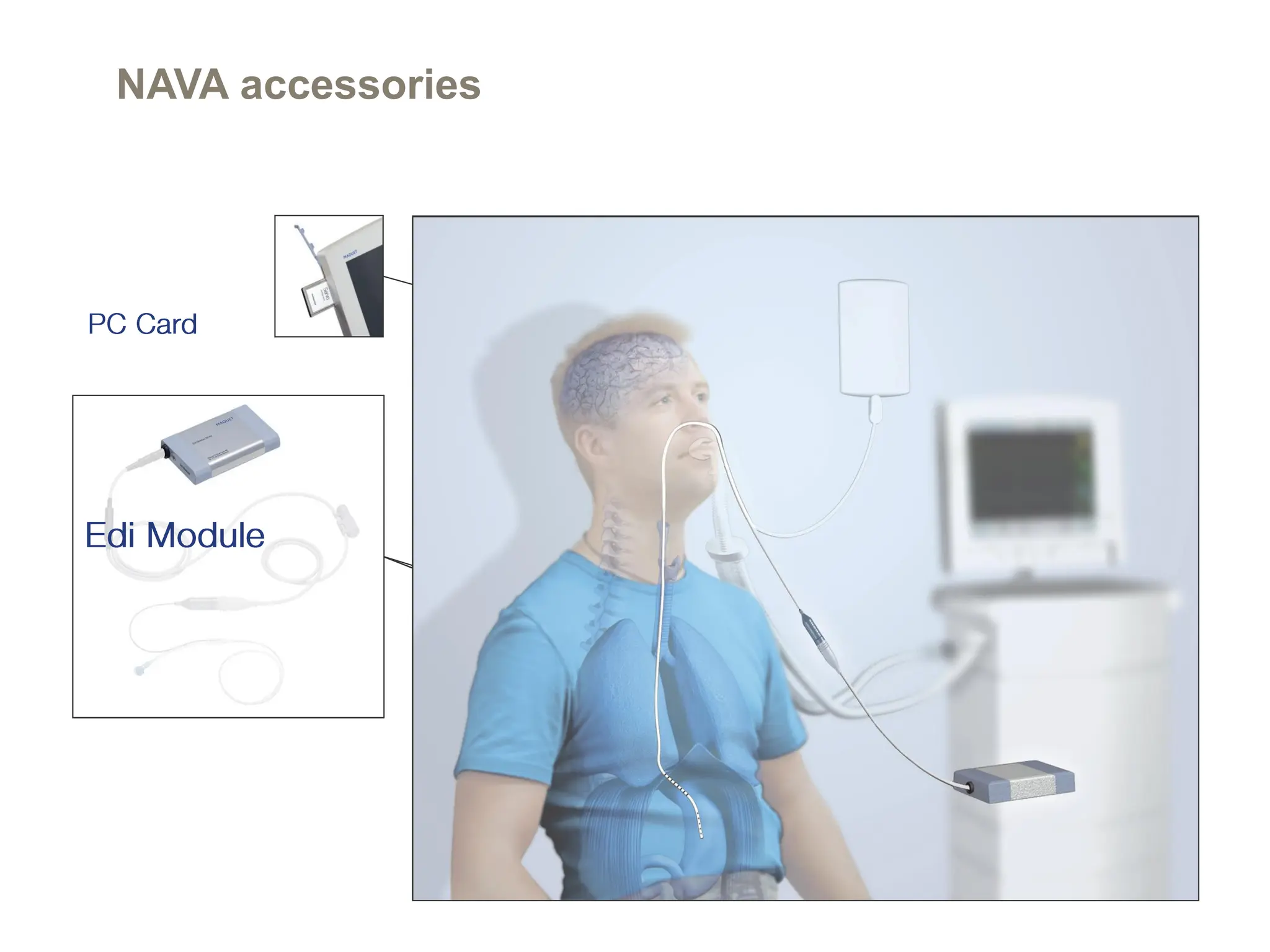 Getinge ventilation strategy using nava ventilation | PDF