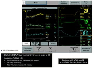 Getinge ventilation strategy using nava ventilation | PDF