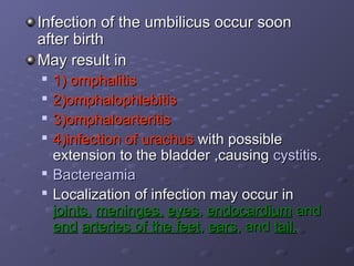 Naval ill Bacterial Infection of the umbilicus and its associated ...