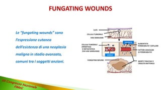 La gestione domiciliare del paziente con fungating wounds | PPTX ...