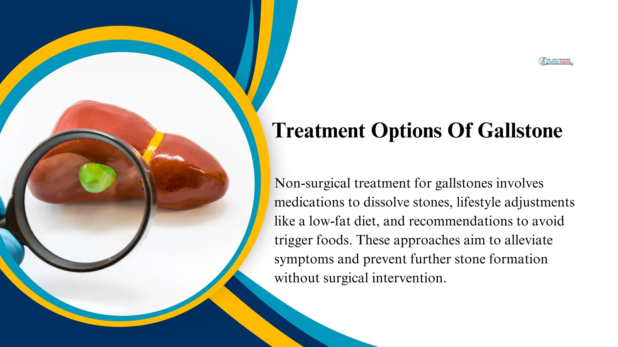 Navigating Gallstone Surgery A Comprehensive Guide | PDF | Digestive ...