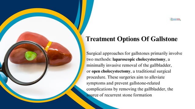 Navigating Gallstone Surgery A Comprehensive Guide | PPT