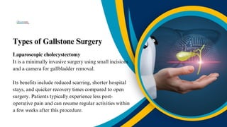 Navigating Gallstone Surgery A Comprehensive Guide | PDF | Digestive ...