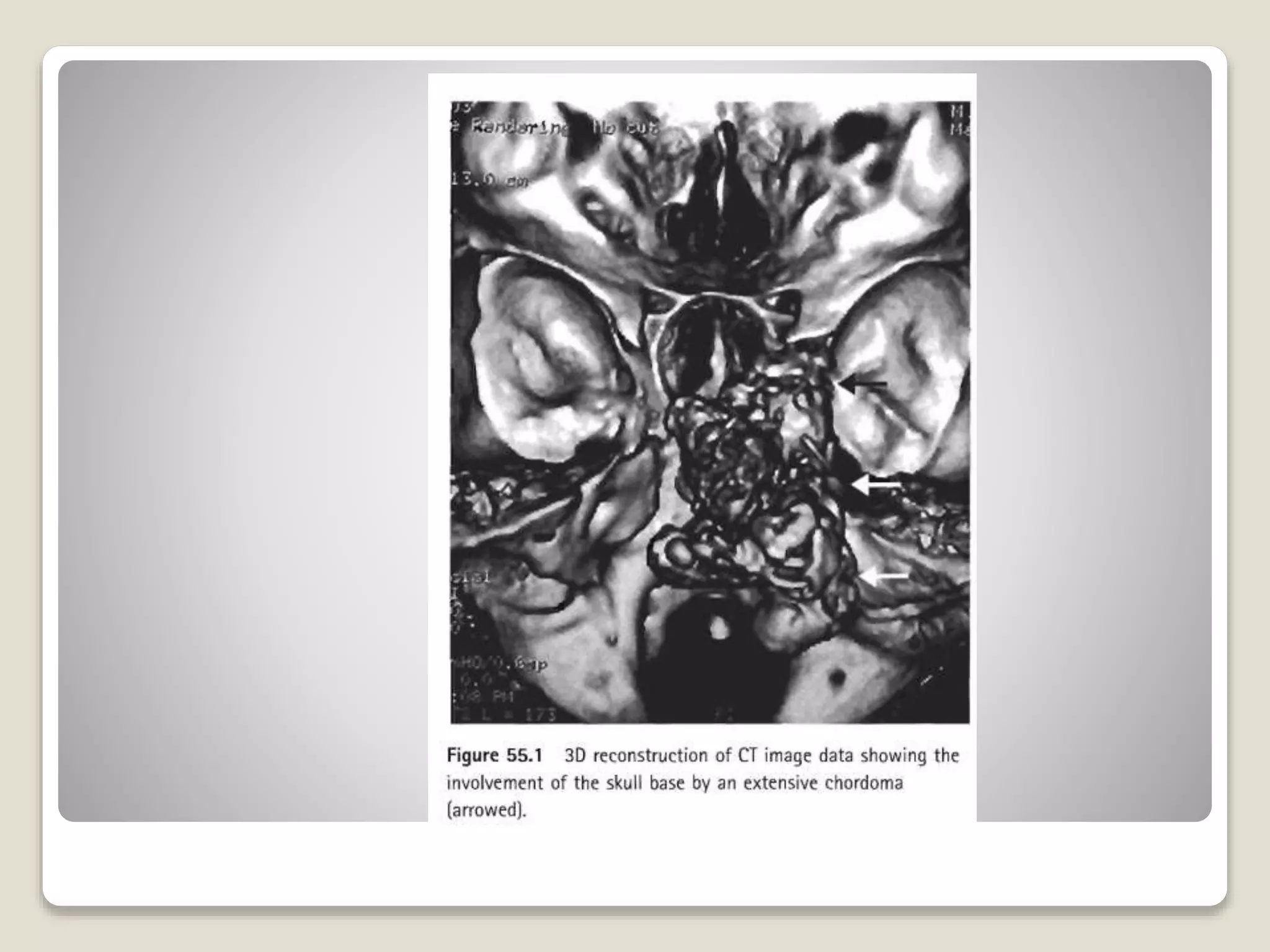 IMAGE GUIDED SURGERY | PPTX