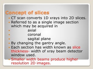 IMAGE GUIDED SURGERY | PPTX