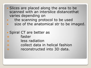 IMAGE GUIDED SURGERY | PPTX