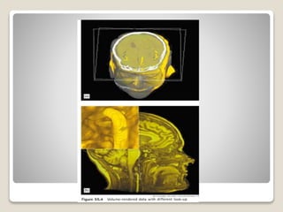 IMAGE GUIDED SURGERY | PPTX