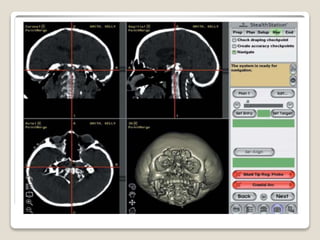 IMAGE GUIDED SURGERY | PPTX
