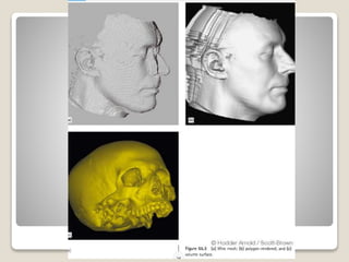 IMAGE GUIDED SURGERY | PPTX