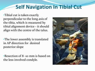 Navigation Assisted Total Knee Replacement | PPTX