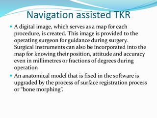 Navigation Assisted Total Knee Replacement | PPTX