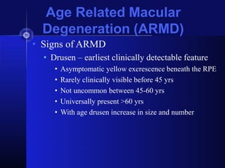 ARMD with basic retinal anatomy and management of armd | PPT