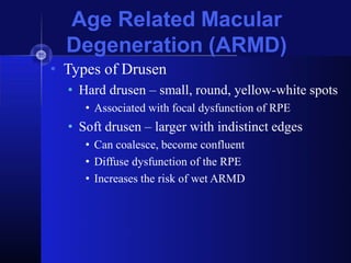 ARMD with basic retinal anatomy and management of armd | PPT