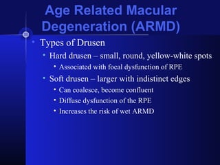 Macular Degeneration | PPT