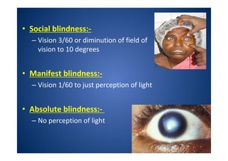 NAVYA KRISHNA-NATIONAL PROGRAMME FOR CONTROL OF BLINDNESS.pdf