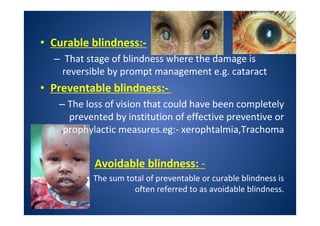 NAVYA KRISHNA-NATIONAL PROGRAMME FOR CONTROL OF BLINDNESS.pdf