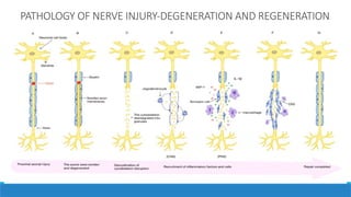 Peripheral nerve injury classification.pptx