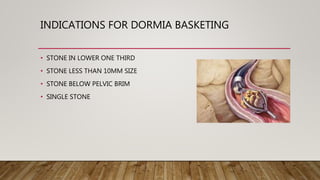 URETERIC CALCULI | PPTX