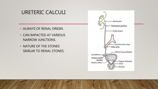 URETERIC CALCULI | PPTX | Digestive Disorders | Diseases and Conditions