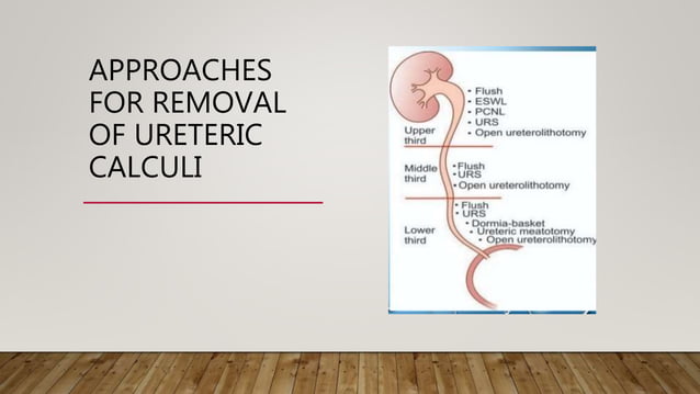 URETERIC CALCULI | PPTX | Digestive Disorders | Diseases and Conditions
