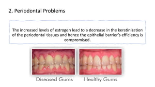 dental problem during pregnancy ........pptx