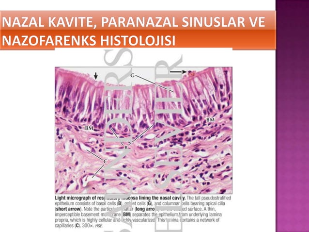 Solunum Sistemi Embriyolojisi, Nazal kavite, paranazal sinus ...
