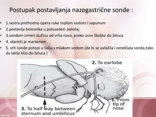 Nazogastricna sonda | PPTX