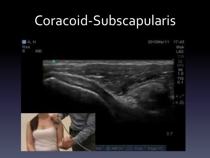 Ultrasound - Shoulder