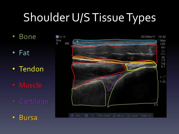 Ultrasound - Shoulder