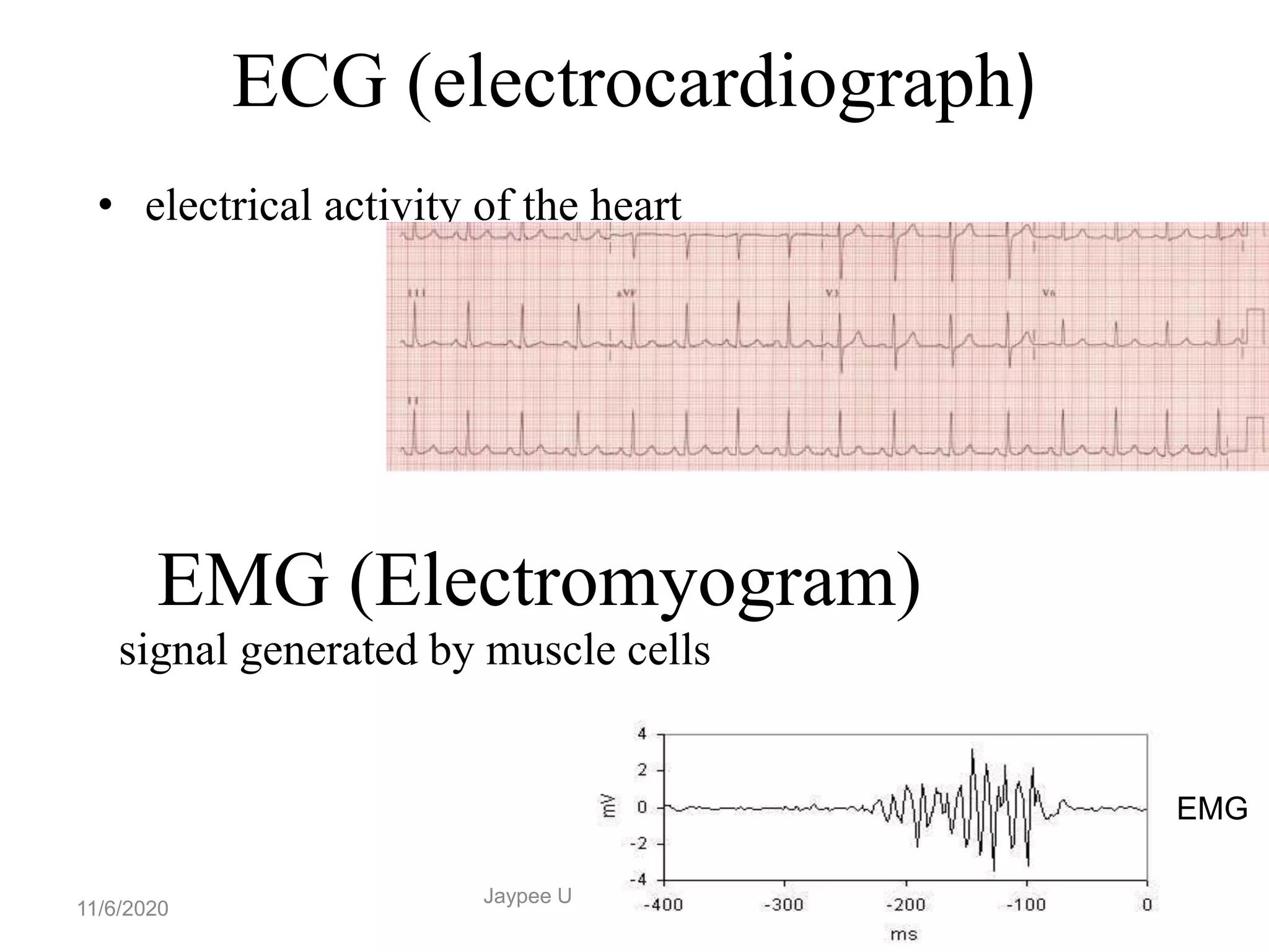 biomedical signal processing | PPT