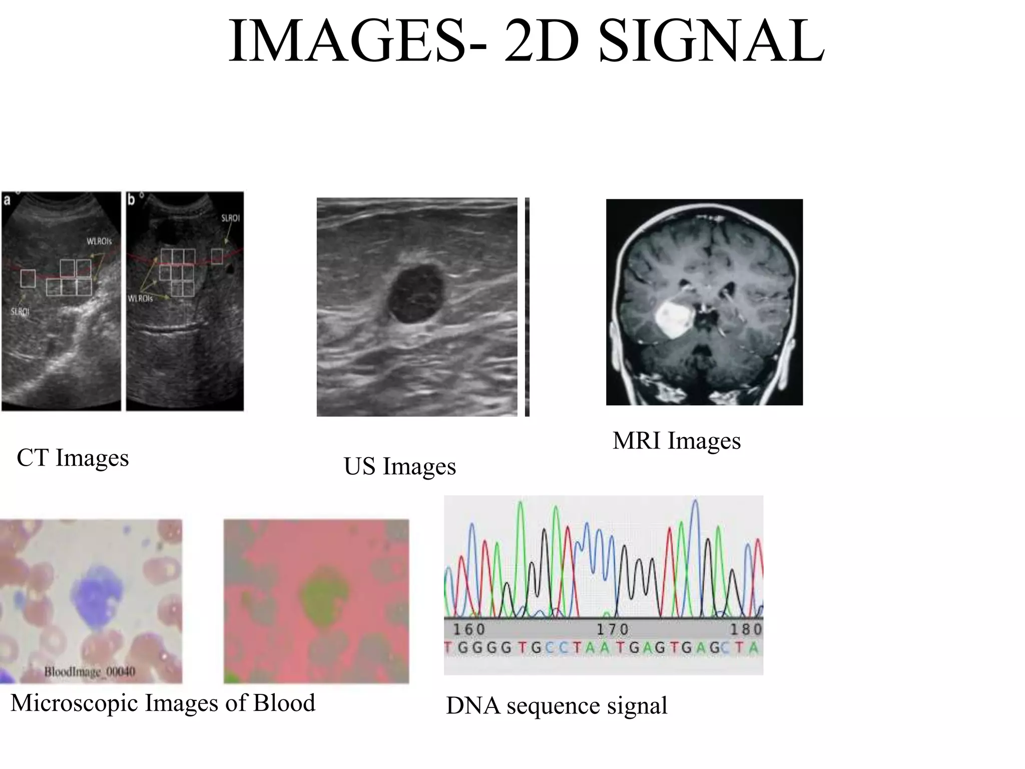 biomedical signal processing | PPT