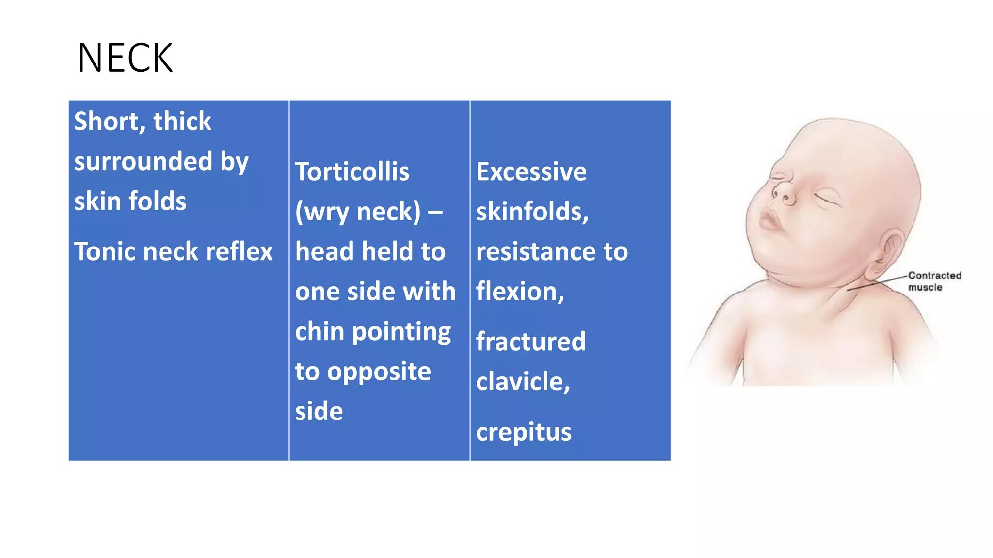 Newborn Examination | PDF