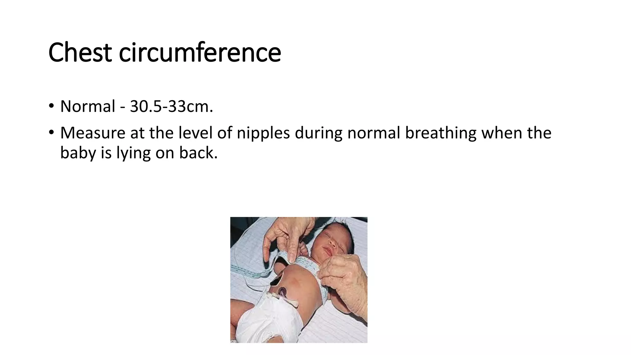 Newborn Examination | PDF