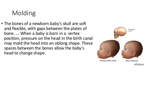 Newborn Examination