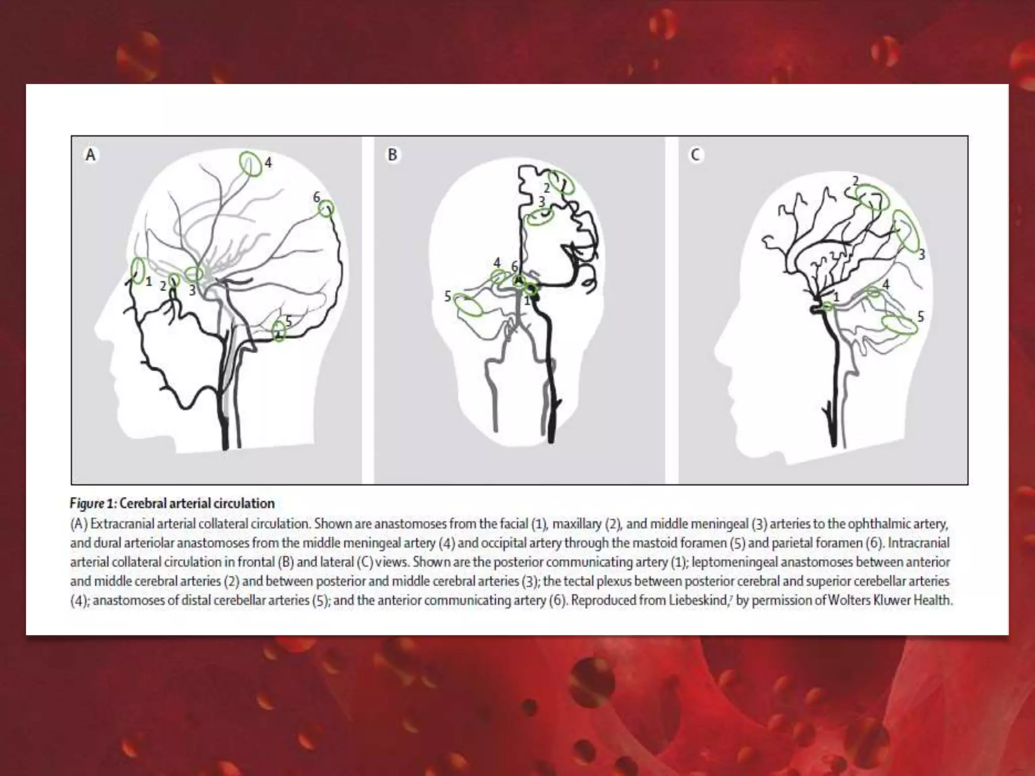 Collateral Blood Flow Dynamics in Stroke | PPT