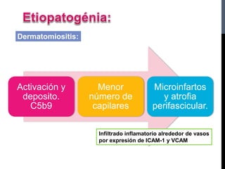 miositis y polimiositis | PPTX
