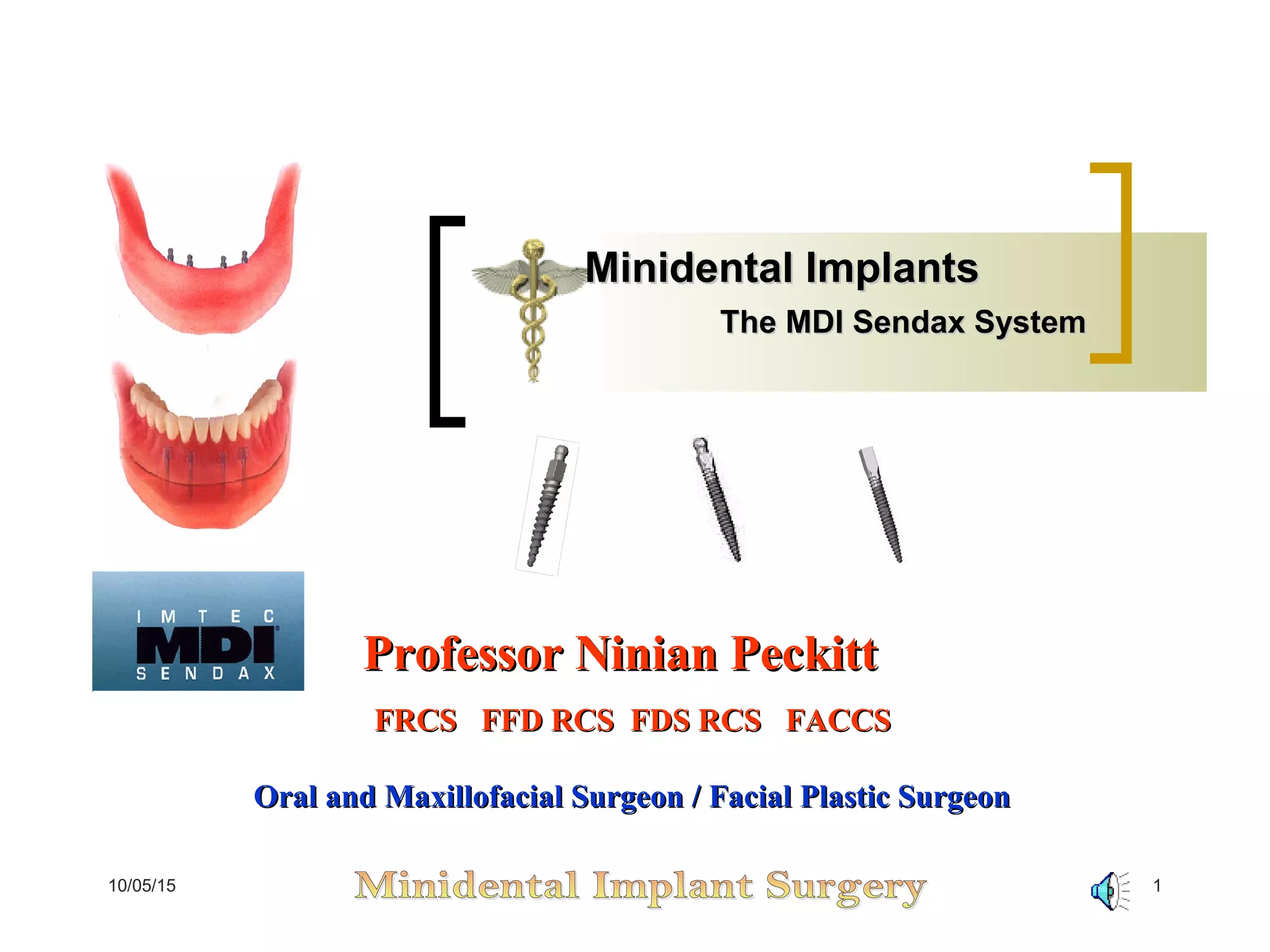 Mini Dental Implants | PPT