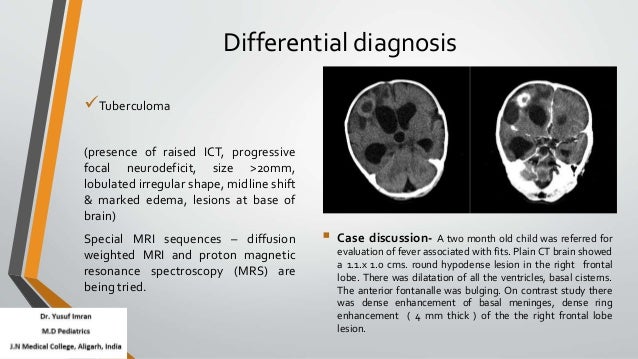 Neurocysticercosis