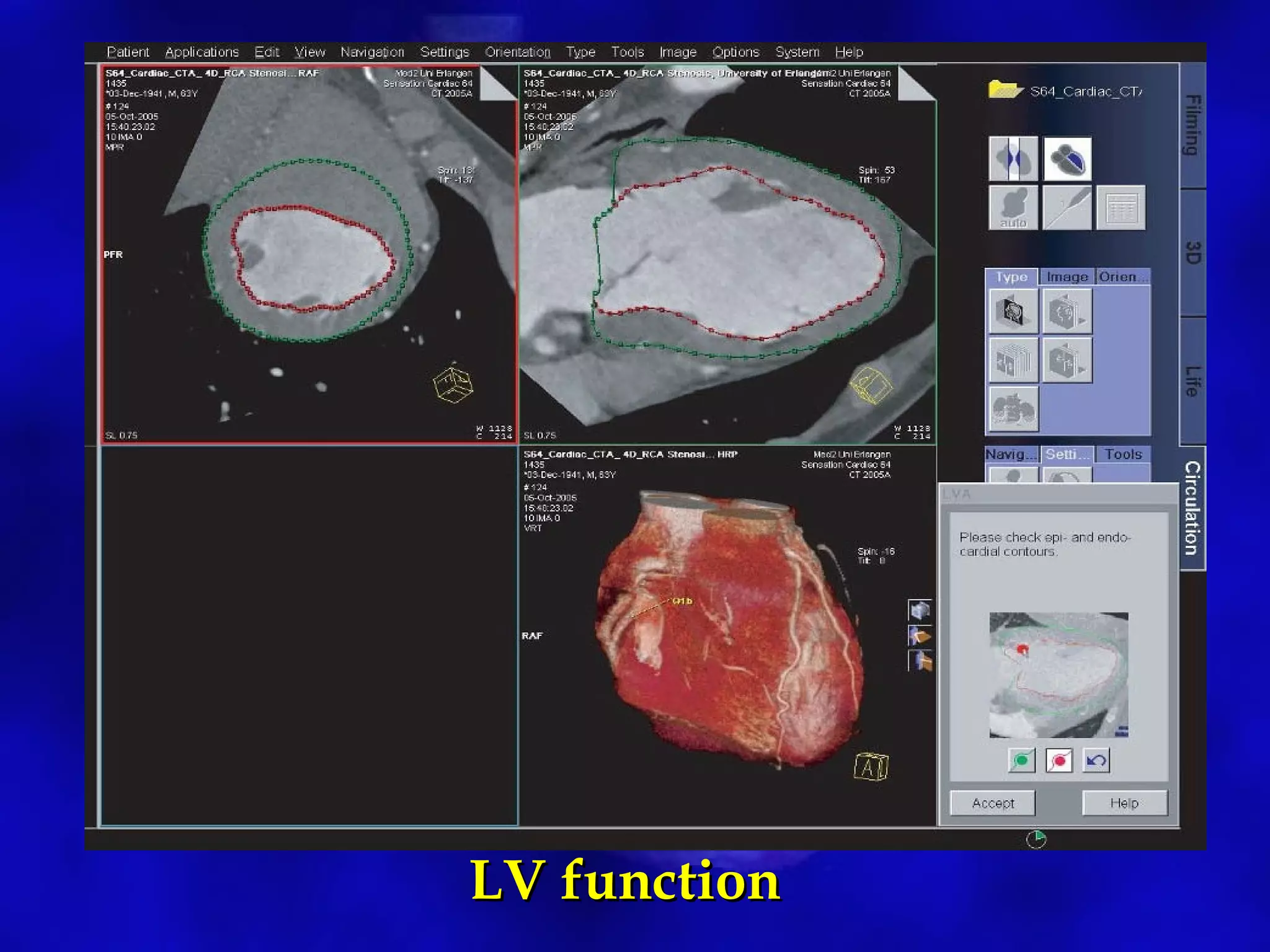 Non coronary cardiac CT | PPT