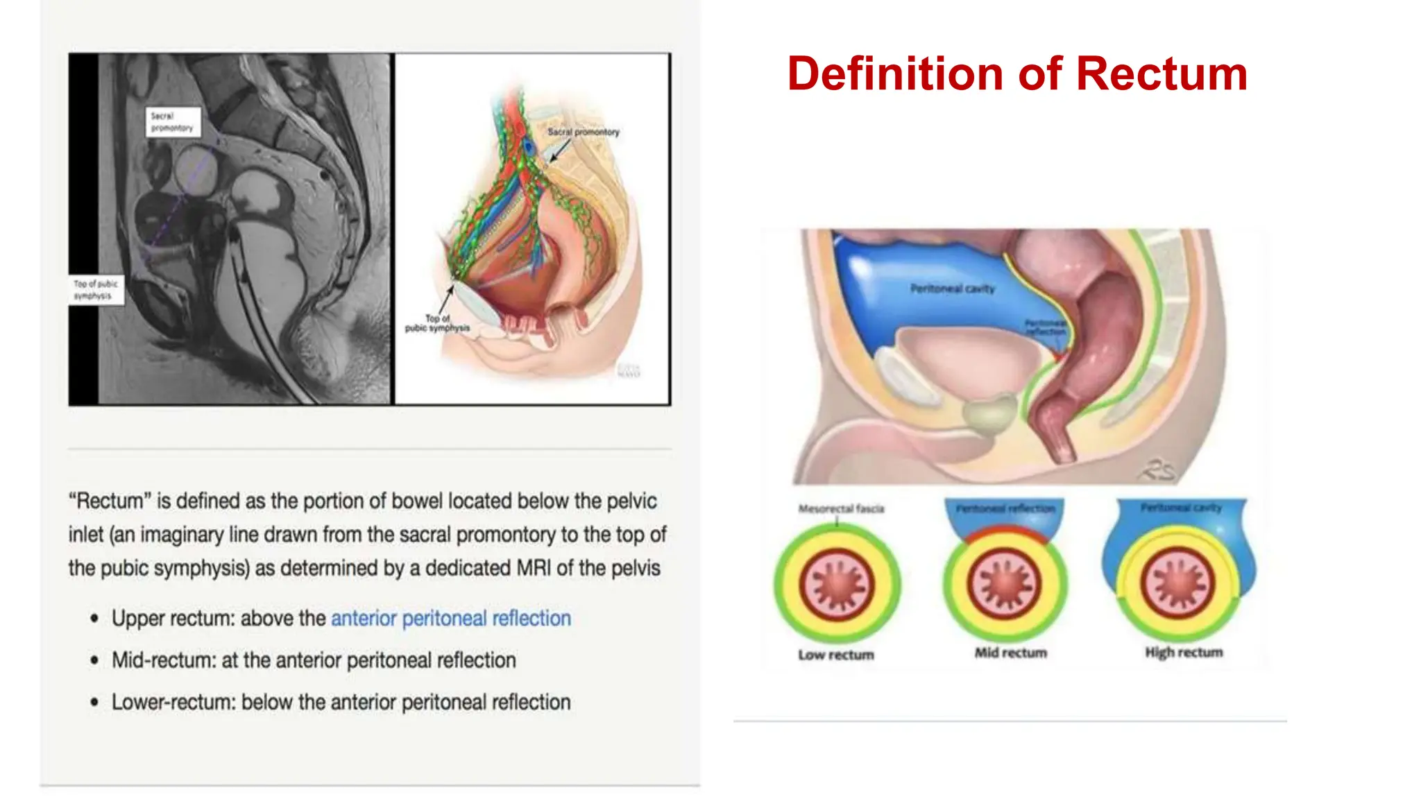 Rectal cancer management , Nccn guideline 2024 .pptx