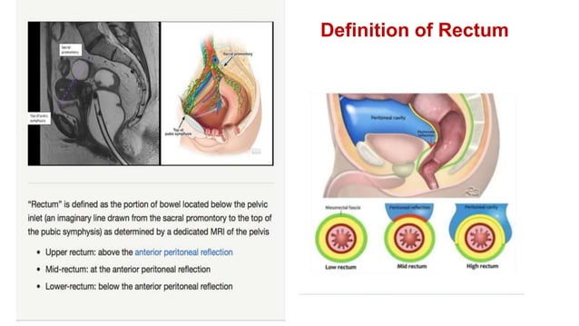 Rectal cancer management , Nccn guideline 2024 .pptx | Digestive Disorders | Diseases and Conditions