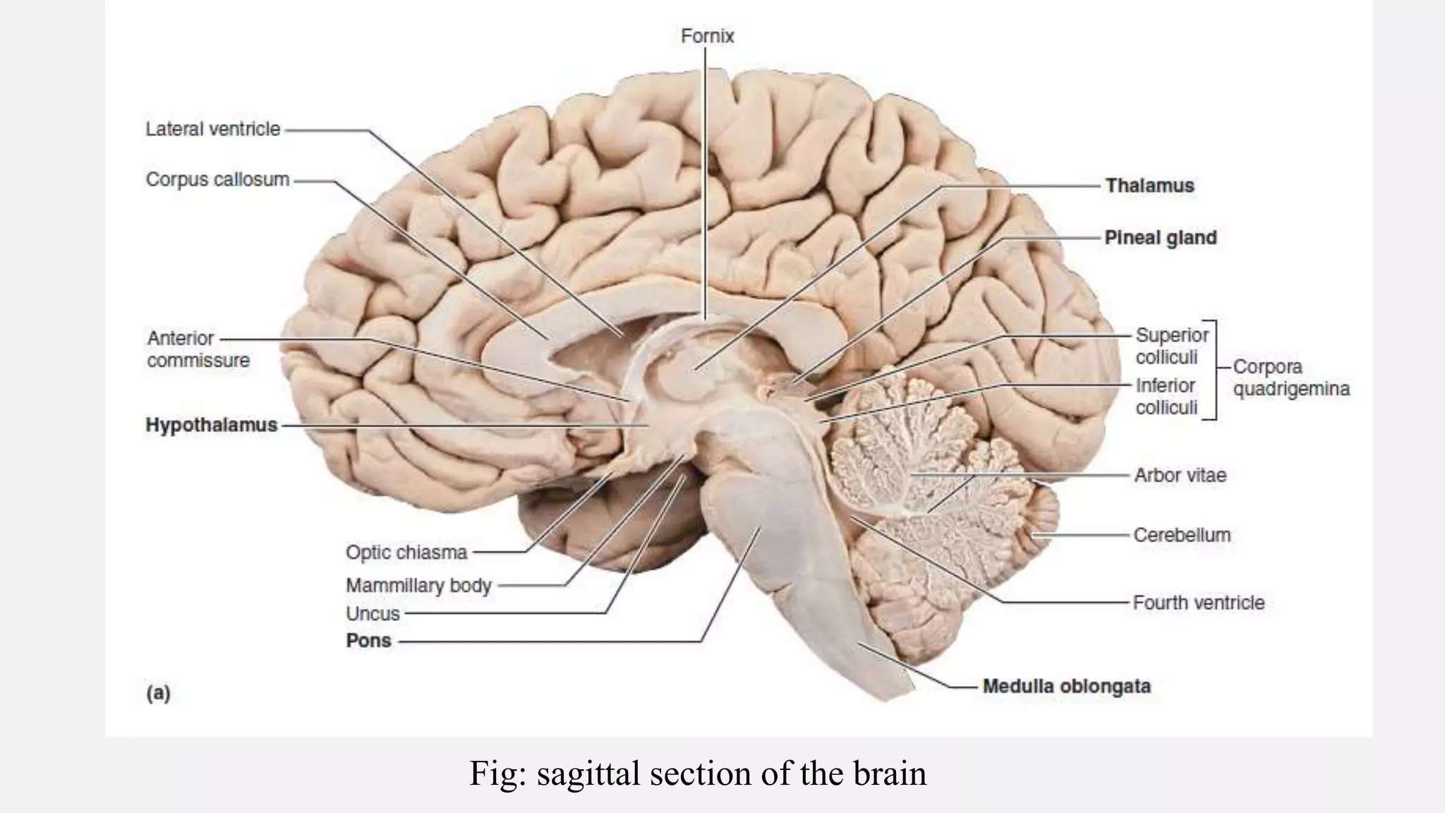 Ncct and cect brain and orbit | PPTX