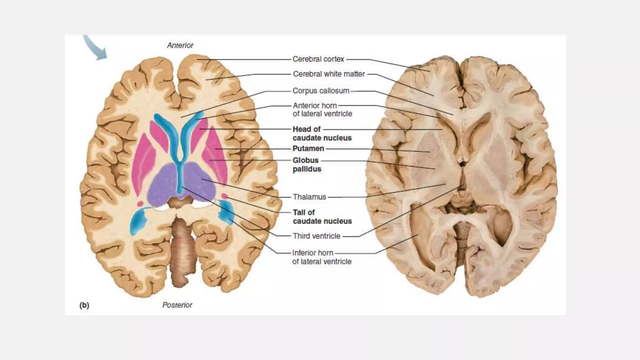 Ncct and cect brain and orbit | PPTX