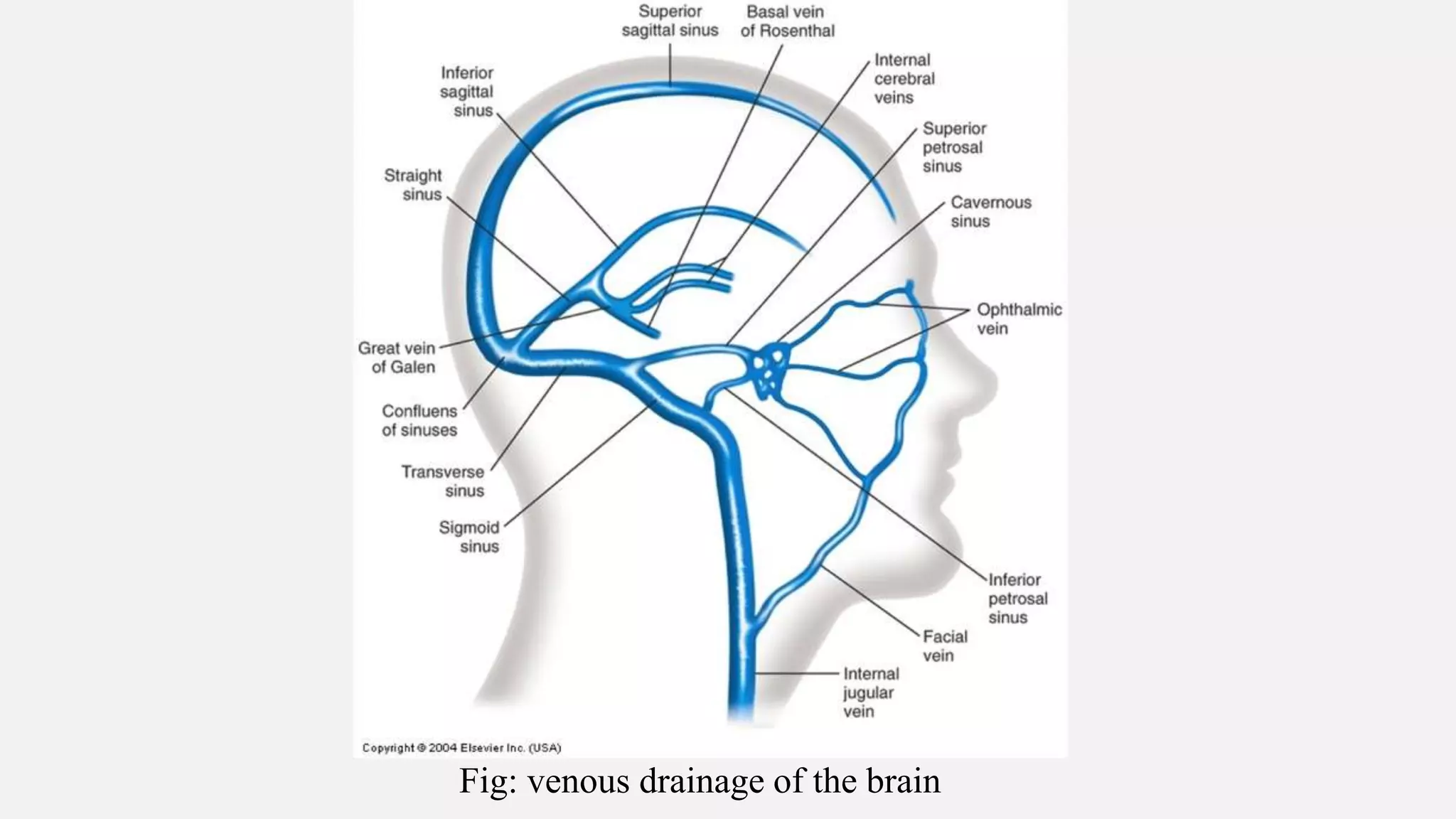 Ncct and cect brain and orbit | PPTX