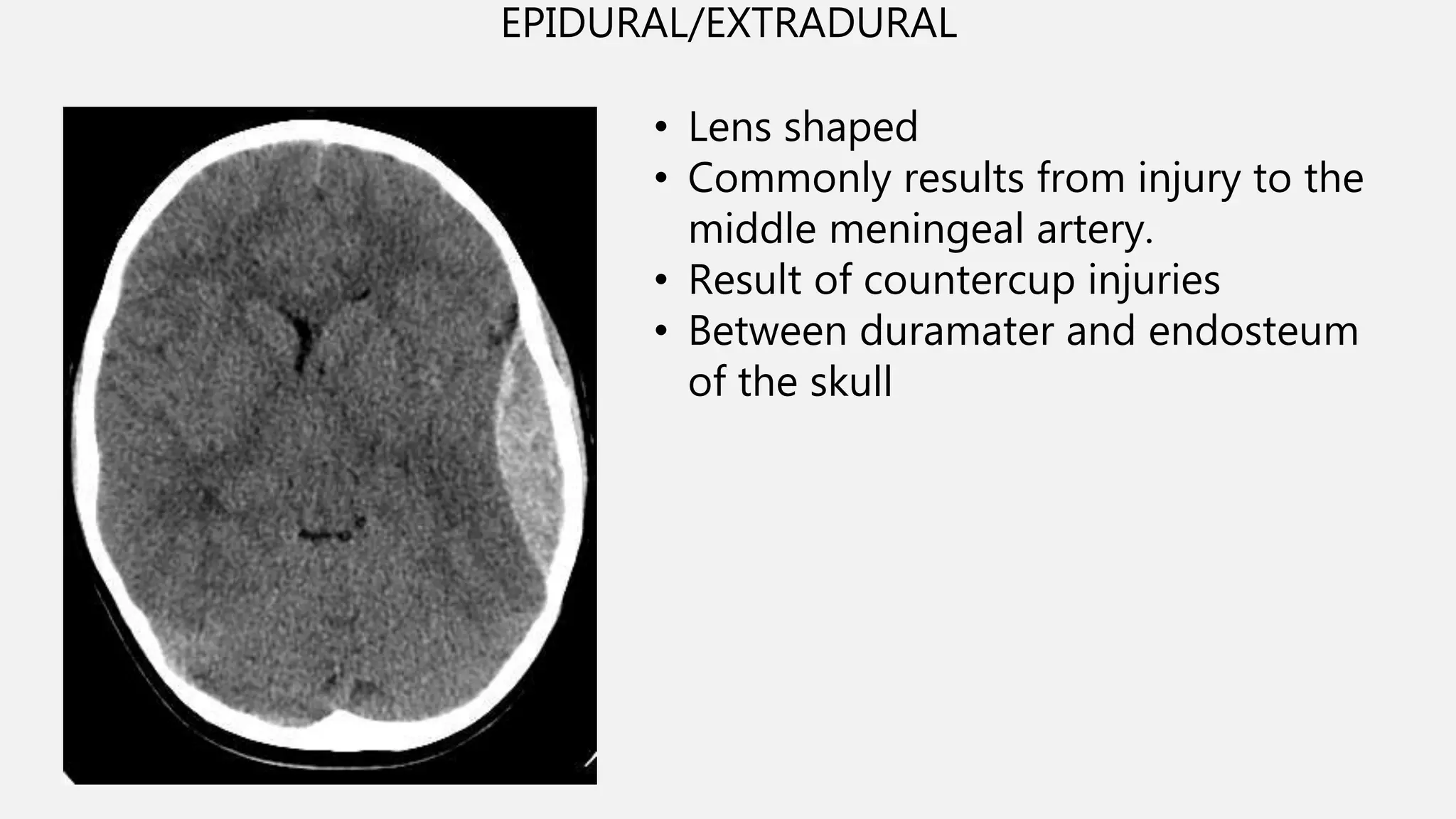 Ncct and cect brain and orbit | PPTX