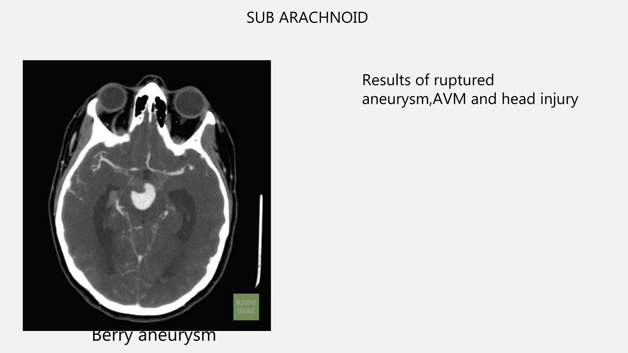 Ncct and cect brain and orbit | PPTX