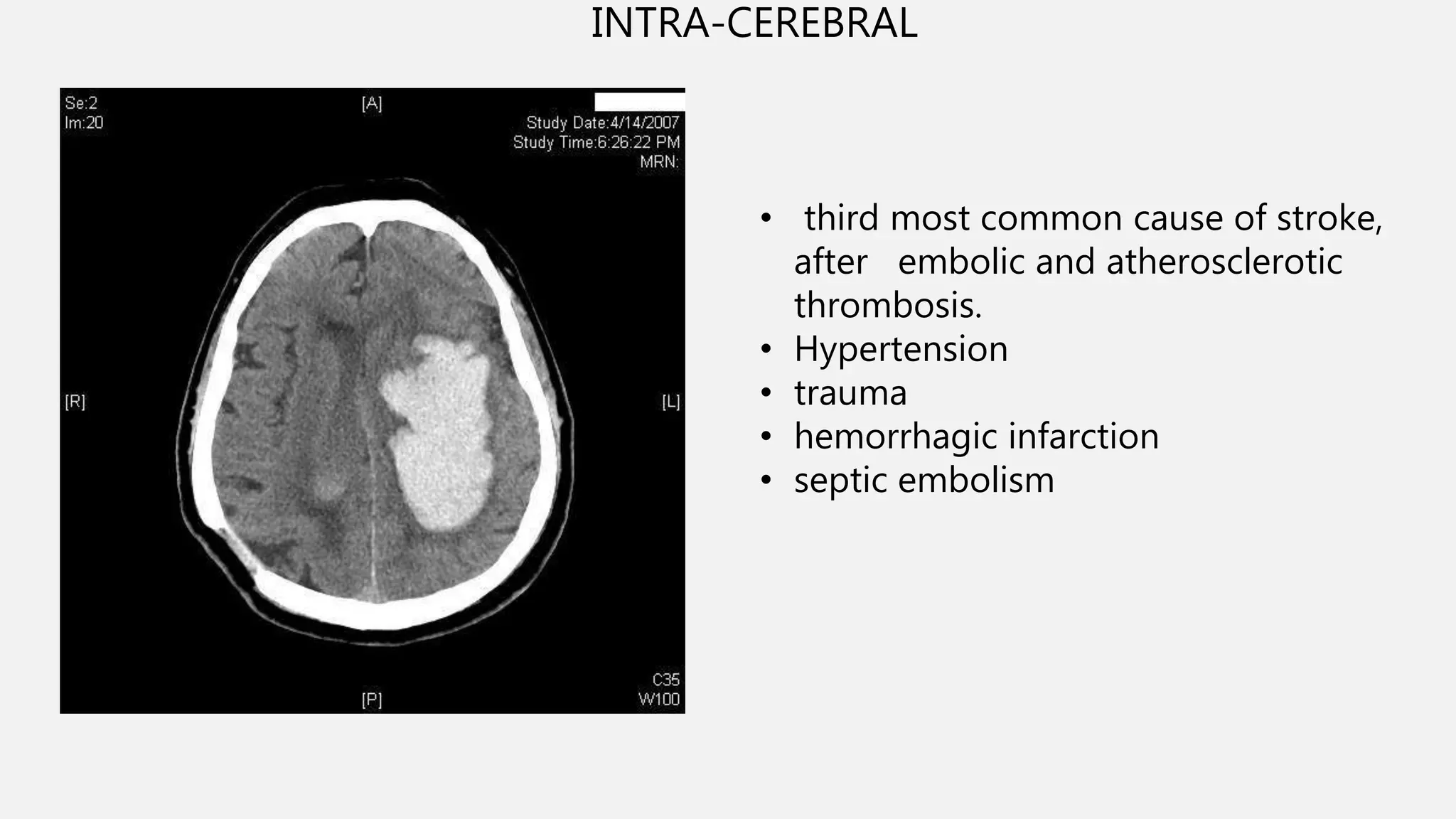 Ncct and cect brain and orbit | PPTX
