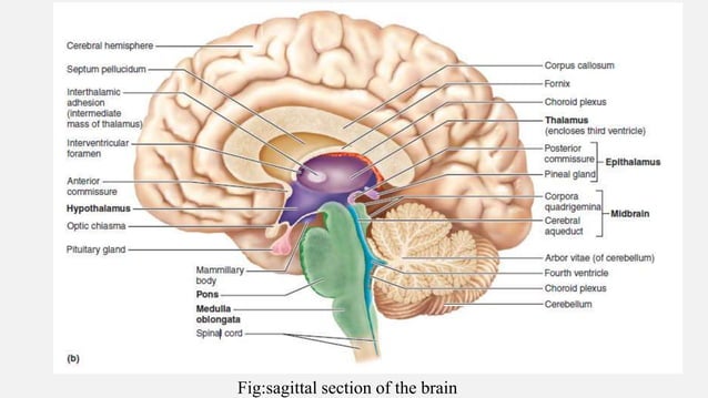 Ncct and cect brain and orbit | PPTX | Blood Disorders | Diseases and ...